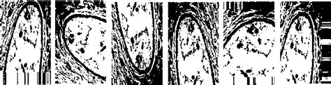 figure 4 from abnormality detection i n breast images using deep