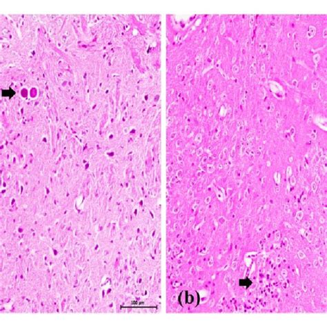 Histopathology Of Te A Toxoplasma Gondii Tissue Cysts Arrow And