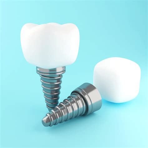 Permanent Tooth Replacement Embracing The Future Of Tooth Replacement