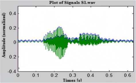 Normalized Amplitude Of The Speech Signal Download Scientific Diagram