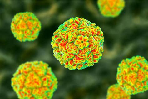 ¿vuelve La Polio Un Virus Similar Que Paraliza A Los Niños Parece