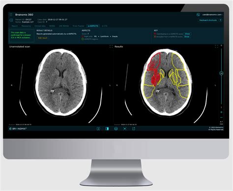 Artificial Intelligence Community • Applied Radiology