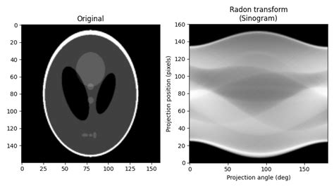 Radon Transform Skimage Documentation