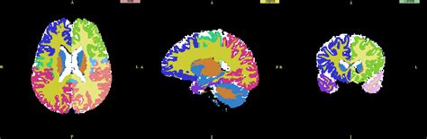 Emsegmenter Tasksmri Human Brain Parcellation Slicer Wiki