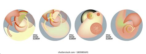 Difference Between Stages Herniated Disc Bulge Stock Vector Royalty