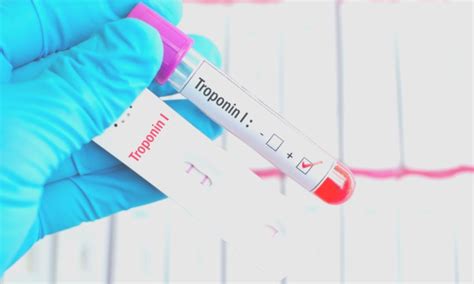 High Sensitivity Cardiac Troponin Test May Overestimate Risk In Pulmonary Embolism Jama