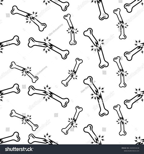 733 Bone Fracture Pattern Royalty Free Images Stock Photos Pictures Shutterstock