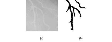 Segmentation Using Rsf Model A Original Image B Segmentation Result Download Scientific