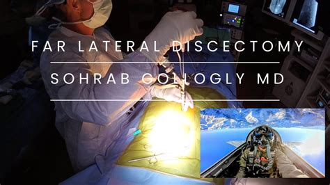 Endoscopic Spine Surgery For A Far Lateral Disc Herniation Youtube