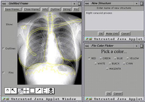 Digital Anatomist Project Description