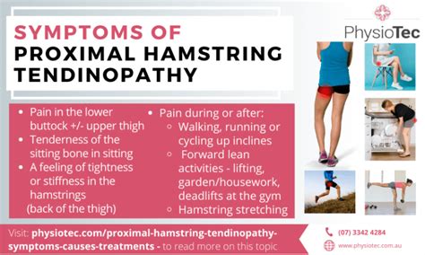 Proximal Hamstring Tendinopathy Symptoms Causes Treatments