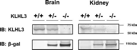 Klhl3 Knockout Mice Reveal The Physiological Role Of Klhl3 And The Pathophysiology Of