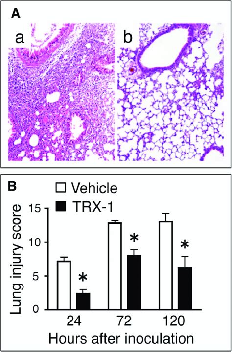 Effects Of Recombinant Human Thioredoxin Trx 1 Treatment On Lung