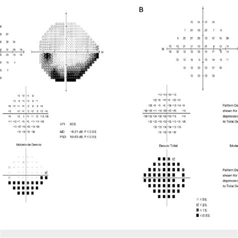 Visual Field Test A Left Eye B Right Eye Download Scientific Diagram