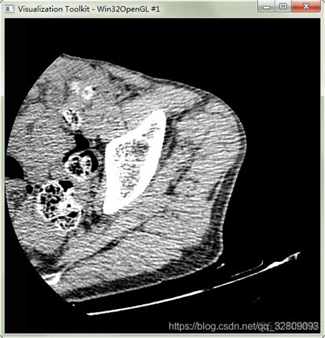 Vtk 实例14:读取dcm医学图像并显示 一杯清酒邀明月 博客园 Vtk 实例14:读取dcm医学图像并显示 一杯清酒邀明月 博客园