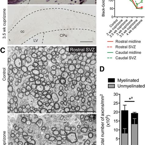 Cuprizone Induced Demyelination In The Entire Cc A Representative Download Scientific Diagram