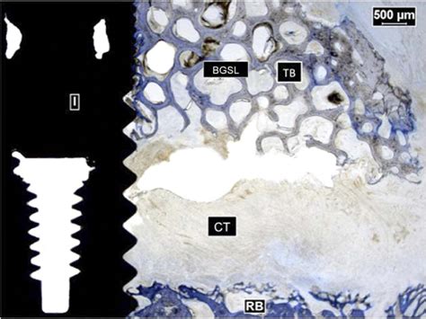 Effects Of Early Functional Loading On Maintenance Of Free Autogenous Bone Graft And Implant