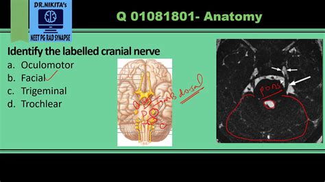 Pin By Dr Amit Sharma On Physiotherapy Cranial Nerves Nerve Anatomy
