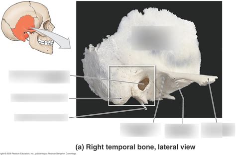 Temporal Bone Diagram Quizlet Temporal Bone Diagram Quizlet