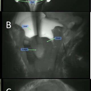 Naked MBs ICG Treatment Group 3M Fluorescence Visualization Of The