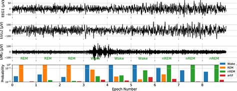 Figure From Automated Classification Of Sleep Stages And Eeg Artifacts In Mice With Deep