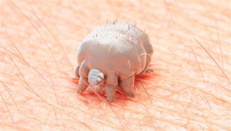 16 Mysterious Microscopic Bugs That Bite And Easy Solutions