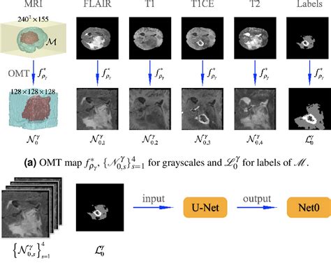 figure 2 from a novel 2 phase u net algorithm combined with optimal