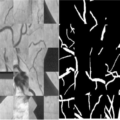 Patches Results For Dense U Net Download Scientific Diagram