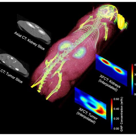 Illustration Of The Possibility Of Quantitative Multimodal Imaging Of