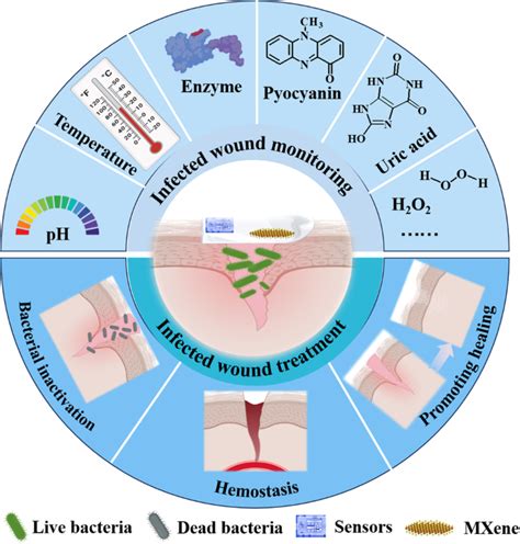 用于伤口感染检测和治疗的基于 Mxene 的柔性电子材料 Npj Flexible Electronics X Mol
