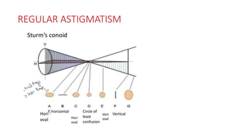 Astigmatism Classification Sturms Conoid Pptx