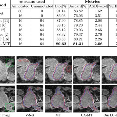 Comparison Results Of Different Segmentation Methods Download