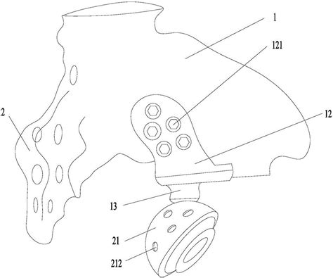 Acetabular Defect Reconstructive Prosthesis Eureka Patsnap