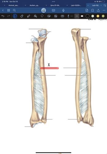 Upper Limb Forearm Flashcards Quizlet