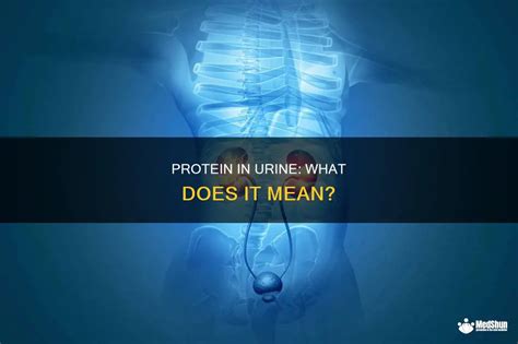 Protein In Urine What Does It Mean Medshun