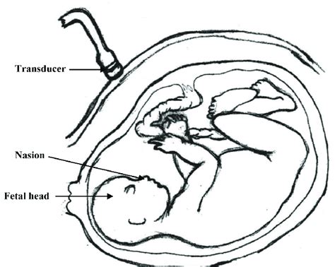 The Transducer In Transverse Plane Download Scientific Diagram
