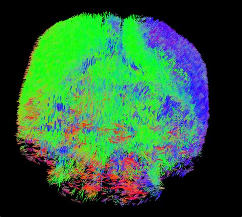 How To Optimize Dti Analysis For Tractography Diffusion Toolkit Dsi