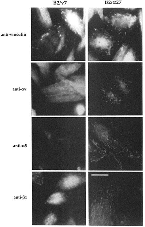 Immunofluorescence Detection Of Integdns And Vinculin In Av And C~5 Download Scientific Diagram
