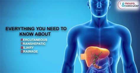 Percutaneous Transhepatic Biliary Drainage Ptbd