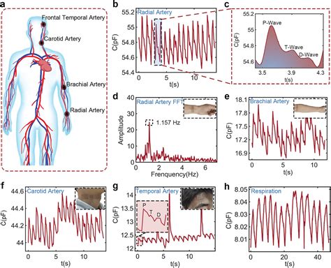 Ultrasensitive Linear Capacitive Pressure Sensor With Wrinkled Microstructures For Tactile