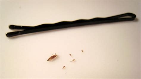 Lice Bugs Actual Size