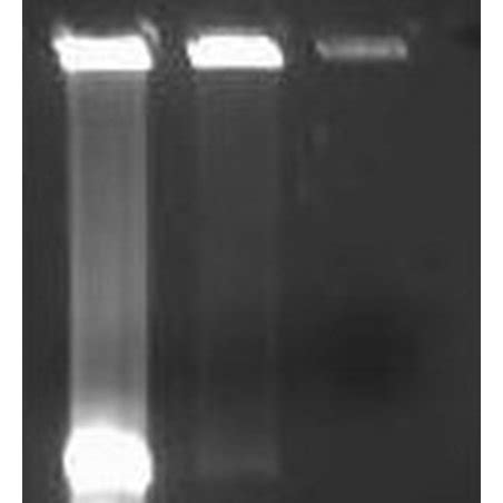 Total RNA Integrity Test On Agarose Gel Intact S And S Total Download Scientific