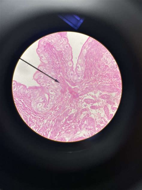 Transitional Epithelial Squamous Cell Tissue Types Basement Membrane