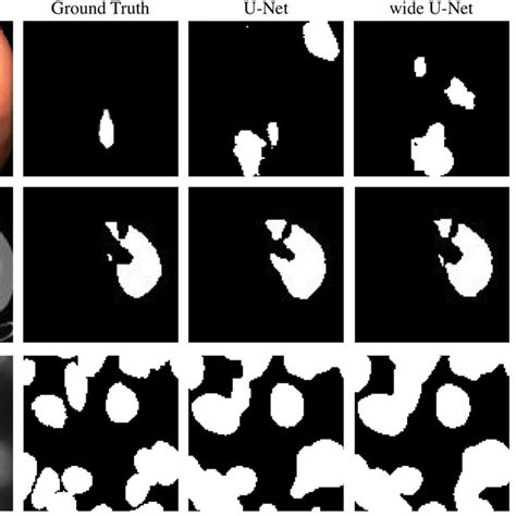 Pdf Unet A Nested U Net Architecture For Medical Image Segmentation