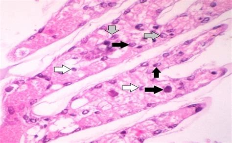Infected Cells With Basophilic Inclusion Bodies Black Arrows