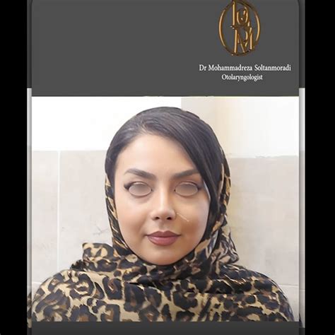 تصاویر جراحی دکتر محمدرضا سلطان مرادی