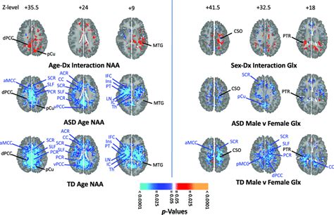 Statistical Parametric Maps On Selected Axial Brain Sections Show