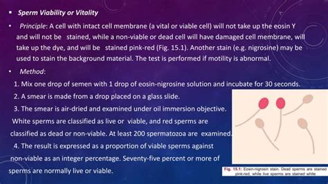 Semen Analysis Or Seminal Fluid Analysis PPTX Infertility Reproductive Health