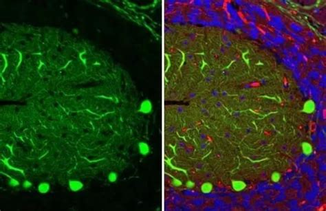 Calbindin D28k Recombinant Rabbit Monoclonal Antibody Hl2379