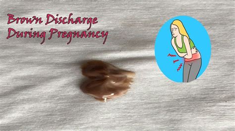 Brown Mucus Discharge